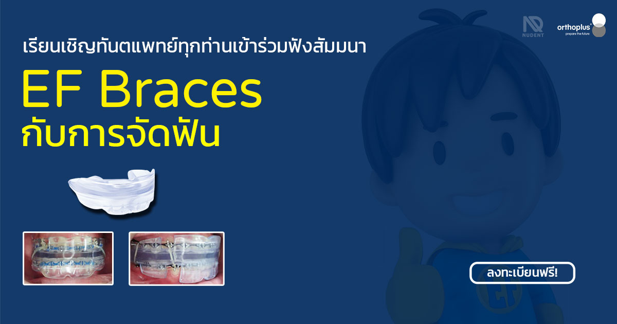 EF Braces กับการจัดฟัน - EF Line Thailand